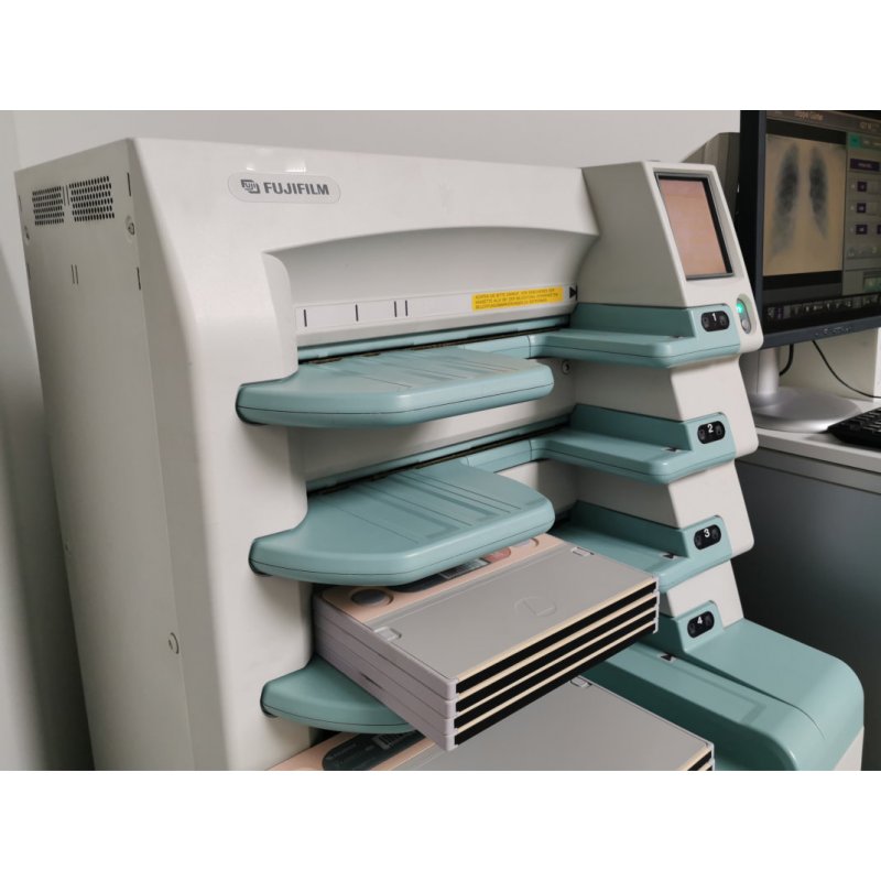 CR System - Fuji - FCR Profect CS - CR-IR 363 - incl. workstation + c