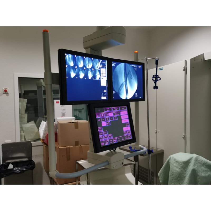 Fluro - Rad Room - Siemens - AXIOM Sireskop SD